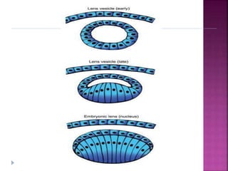 Development of lens | PPTX | Eye and Vision Conditions | Diseases and ...