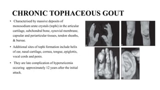 Gout and hyperuricemia | PPTX