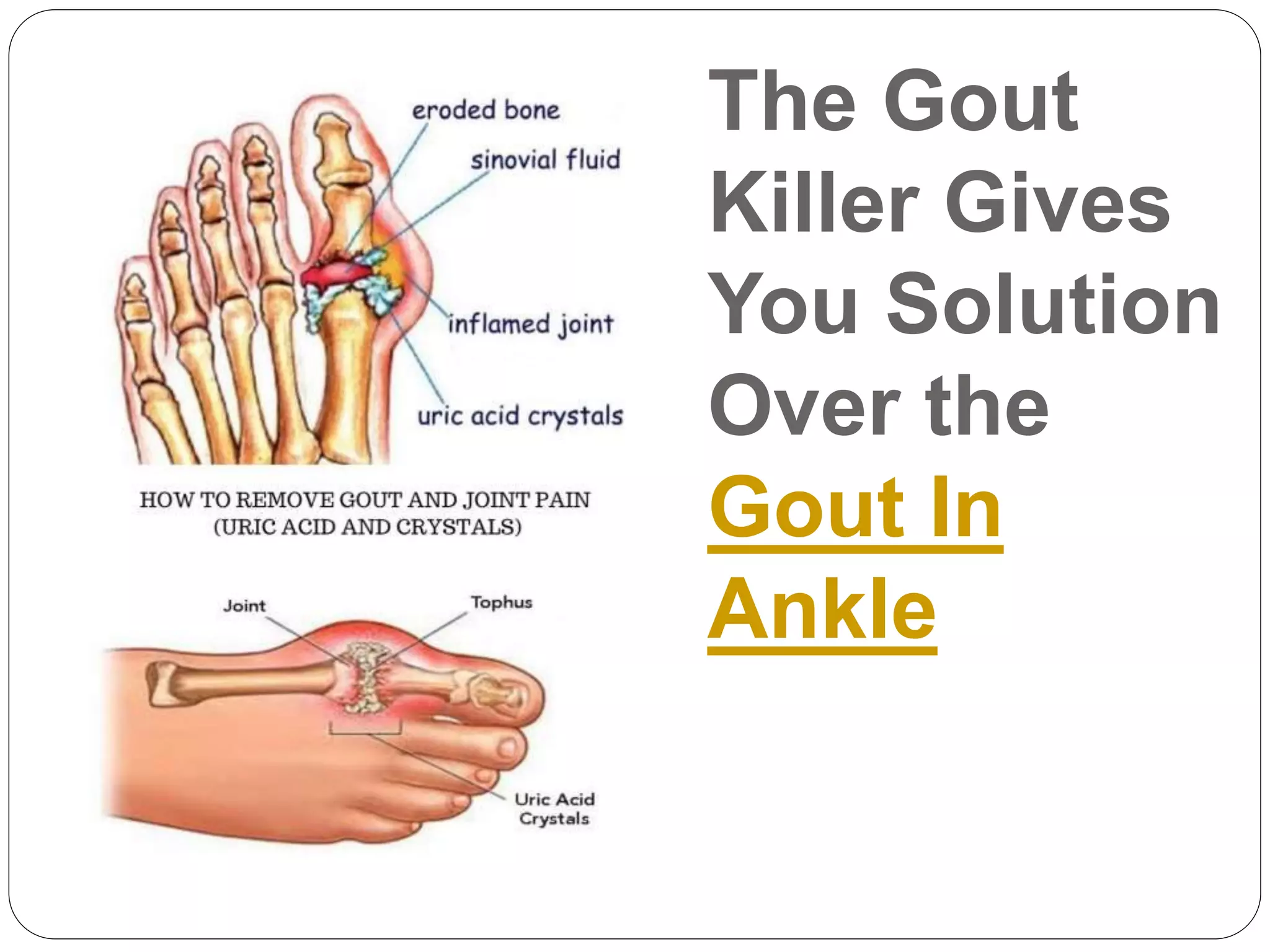 Gout pain medication | PPTX