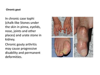 Gout pharmacotherapeutics.pptx