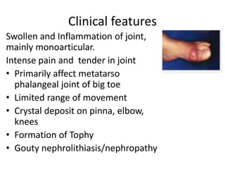 Gout pharmacotherapeutics.pptx