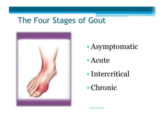 Gout ppt | PPTX