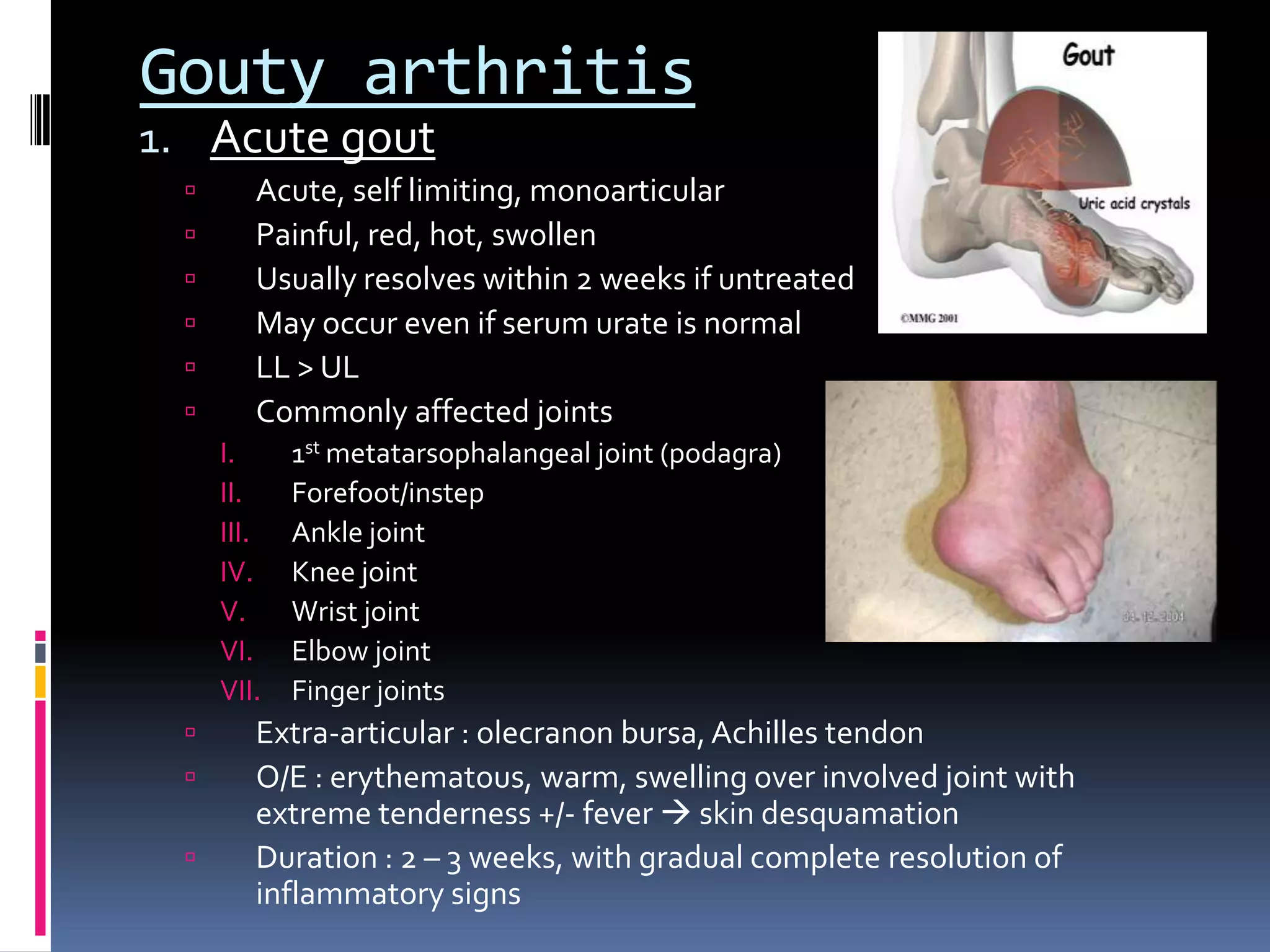 Gout presentation | PPTX