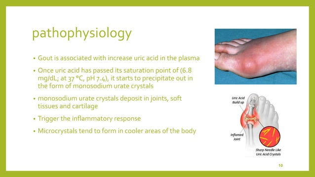 Gout Ppt