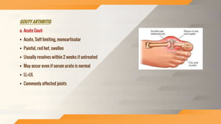 Gout presentation | PPTX