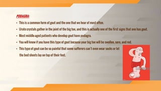 Gout presentation | PPTX