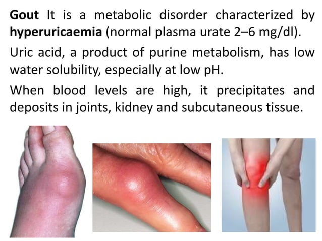 Gout and Rheumatoid arthritis (RA) | PPTX