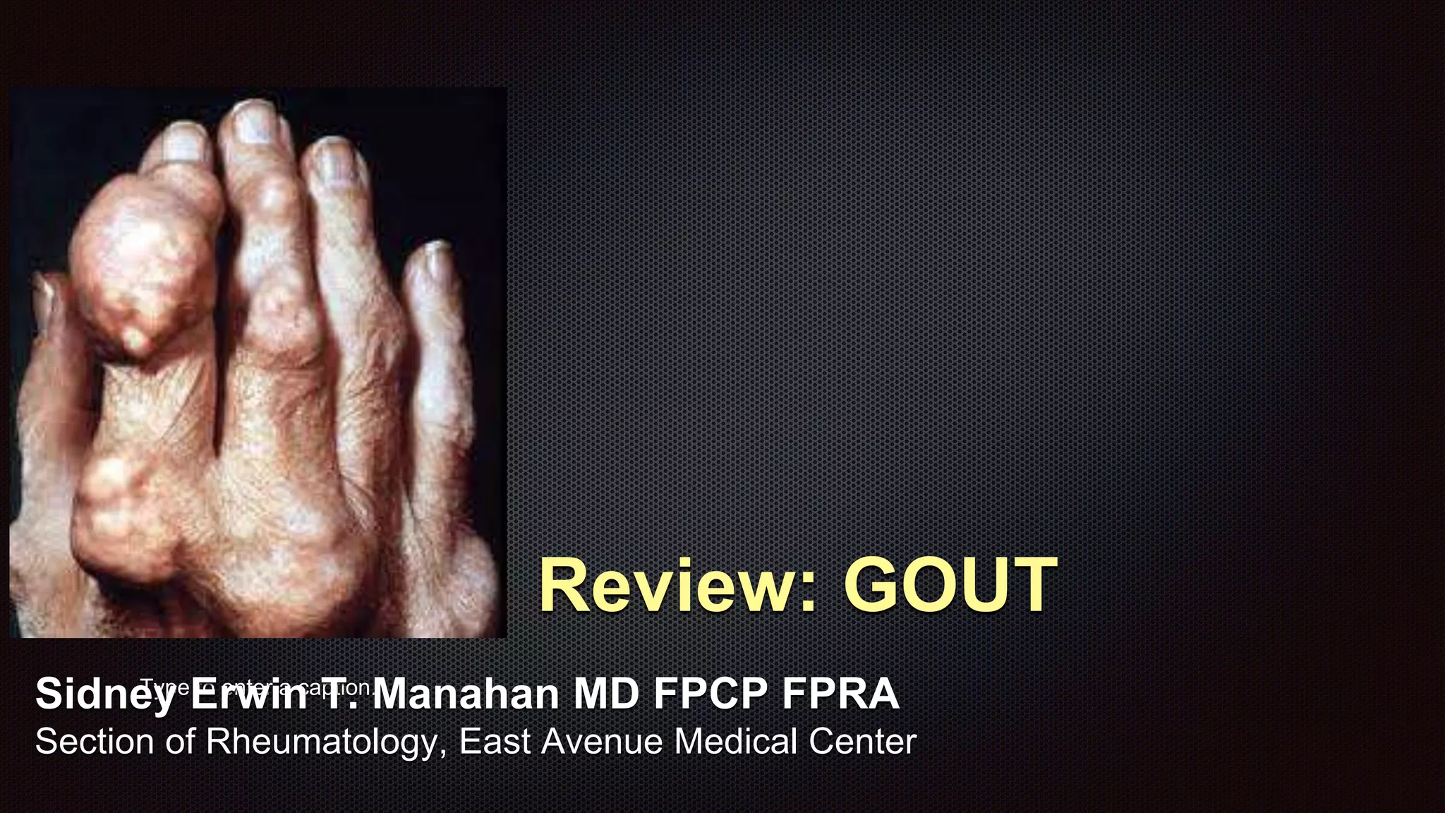 Gout Review for Residents | PPTX