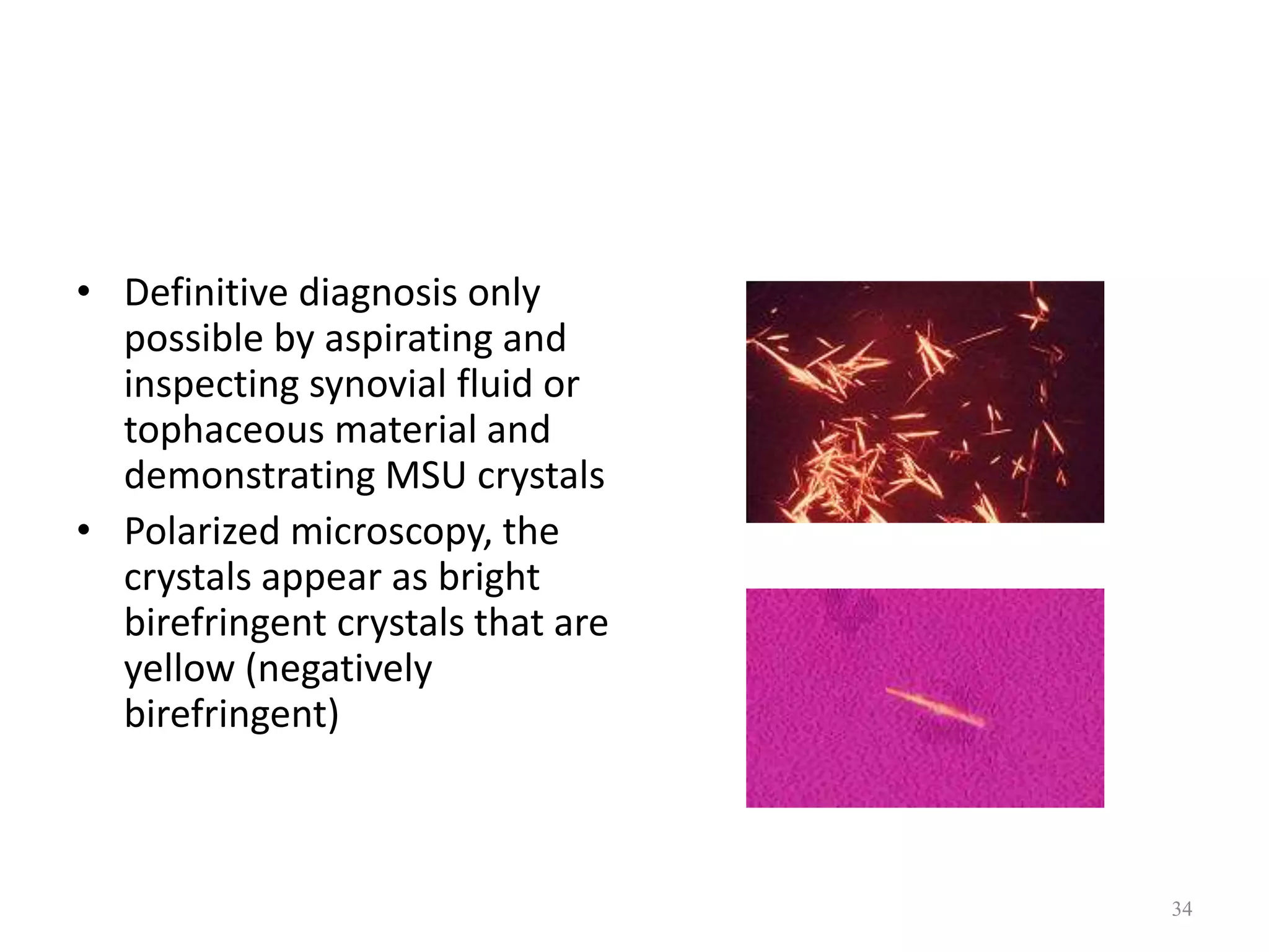 Gout and pseudo gout | PPT