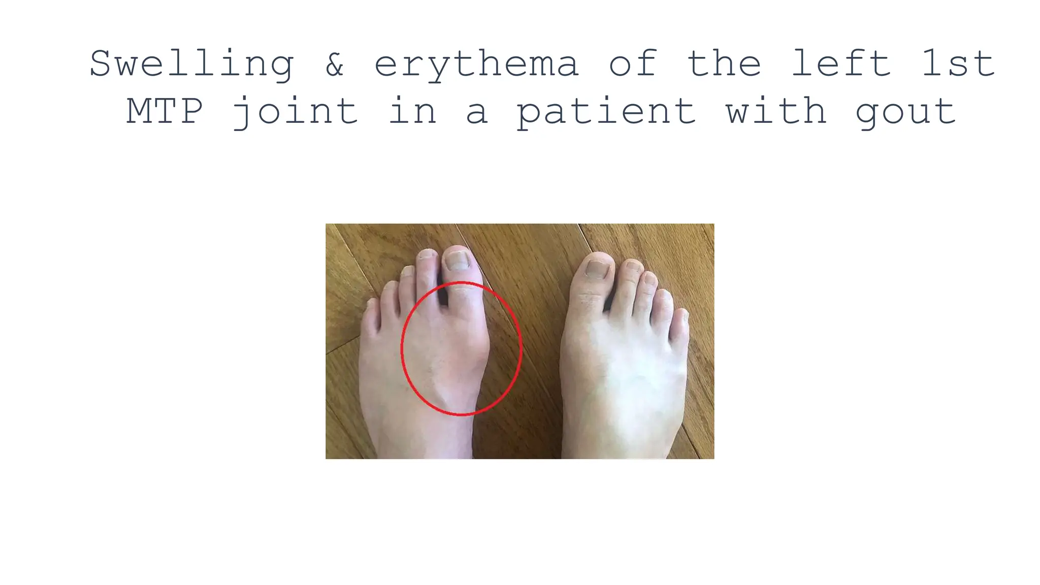 GOUT UPDATE AHMED YEHIA 2024, case based approach with application of ...