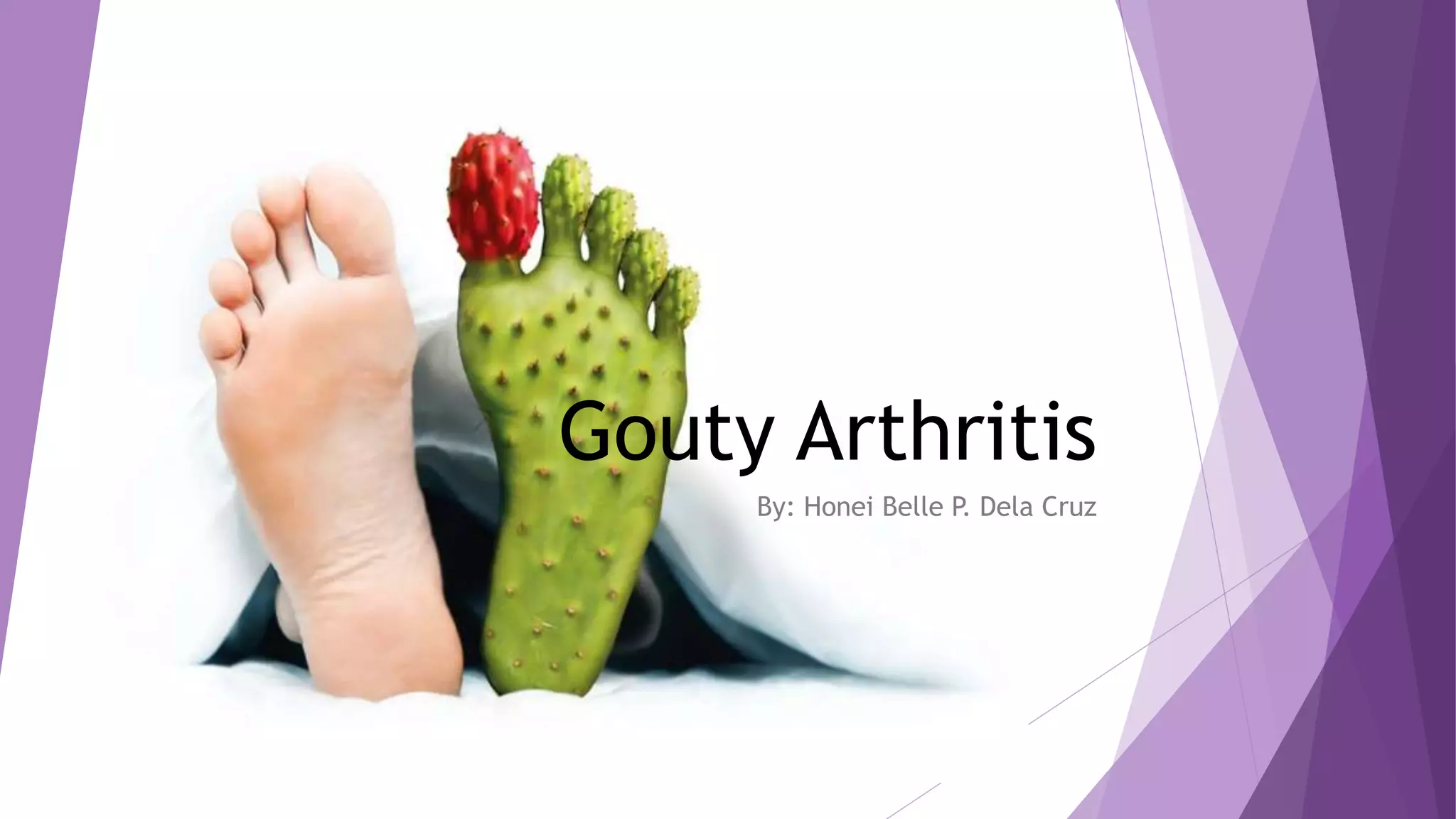 Gouty arthritis | PPT