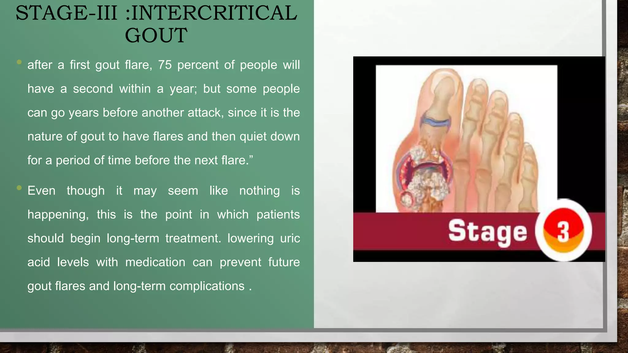 Gouty arthritis | PPTX