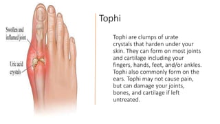 Gouty Arthritis.pptx