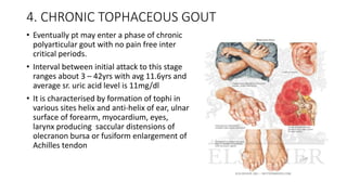 Gout | PPTX