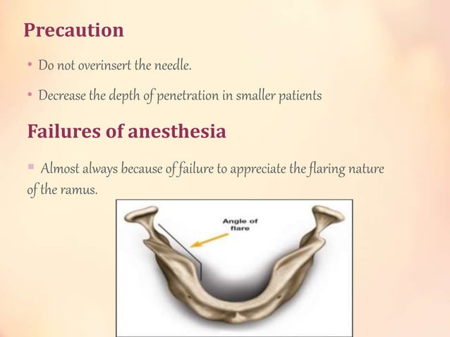 Gow gates & vazirani akinosi technique of nerve | PPTX