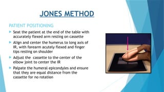 GOWRI -elbow radiographic positioning.pptx