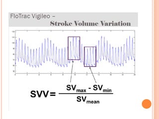 HAEMODYNAMIC MONITORING – CVP, PAC AND IBP | PPTX