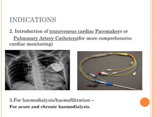 HAEMODYNAMIC MONITORING – CVP, PAC AND IBP | PPTX