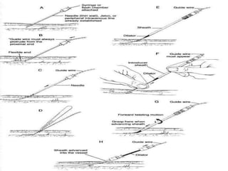 HAEMODYNAMIC MONITORING – CVP, PAC AND IBP | PPTX