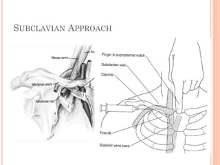 HAEMODYNAMIC MONITORING – CVP, PAC AND IBP | PPTX