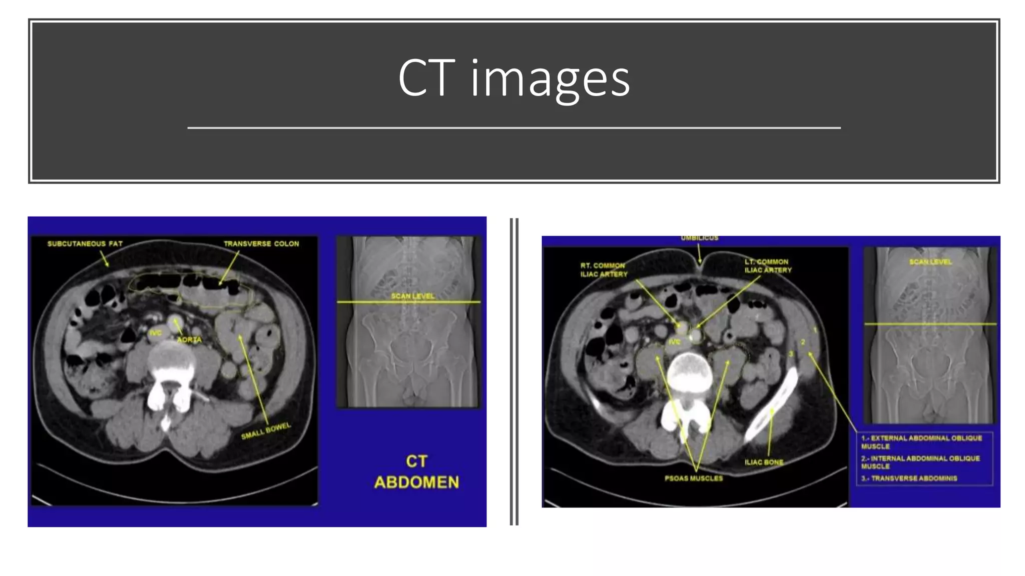 Gowtham's 2nd ca cervix anatomy | PPT