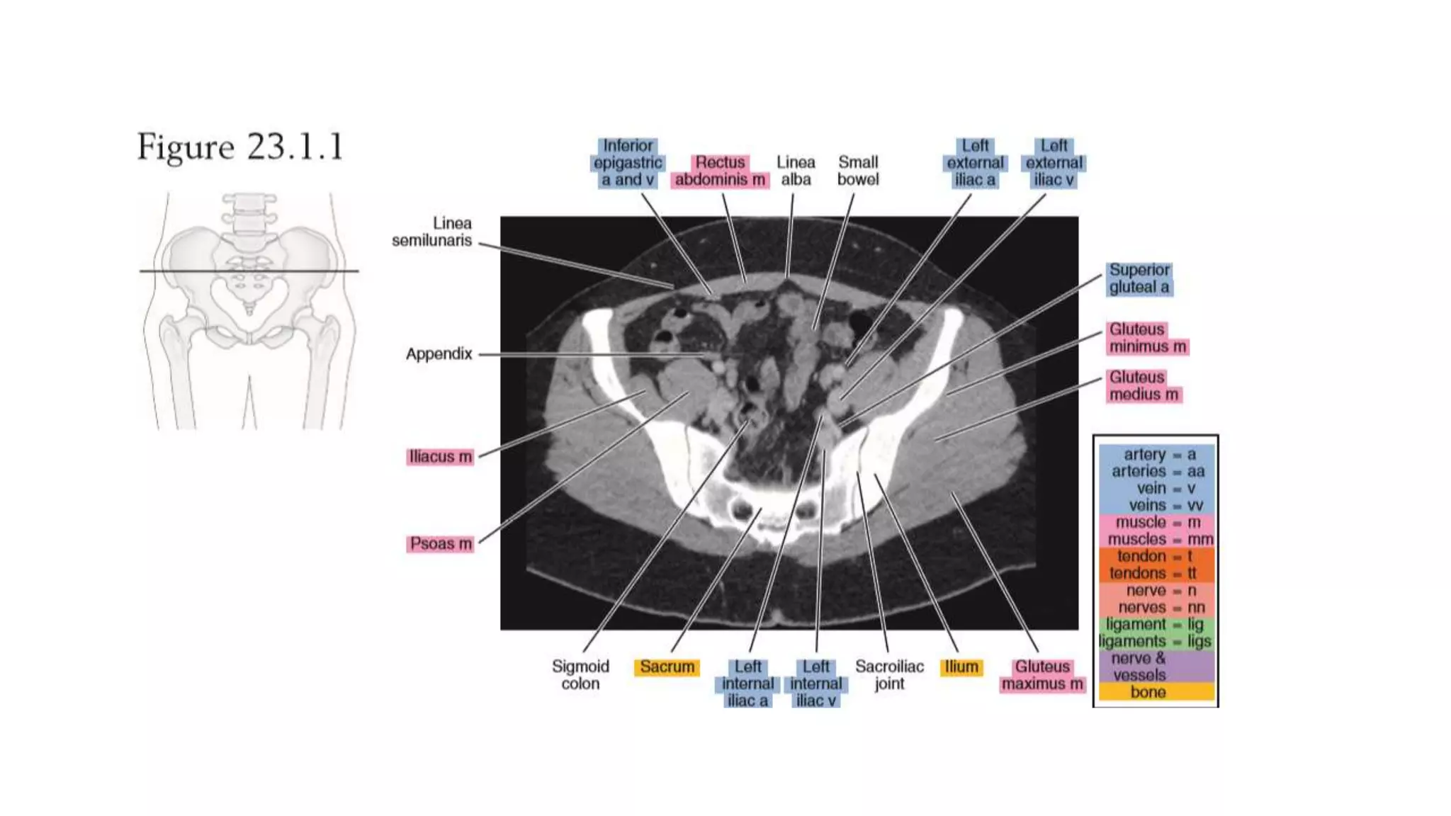 Gowtham's 2nd ca cervix anatomy | PPT