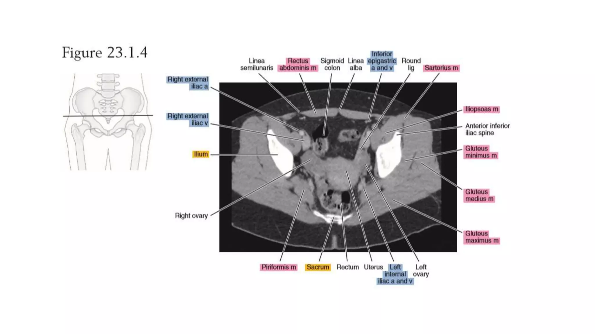 Gowtham's 2nd ca cervix anatomy | PPT