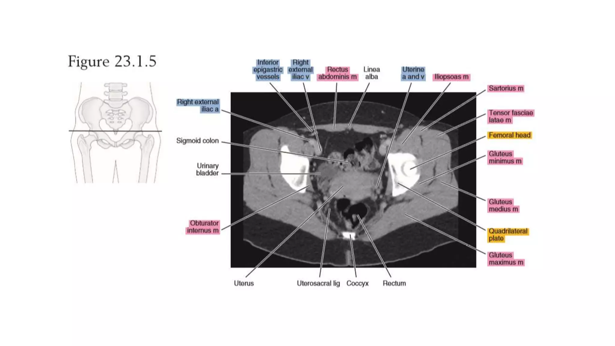 Gowtham's 2nd ca cervix anatomy | PPT