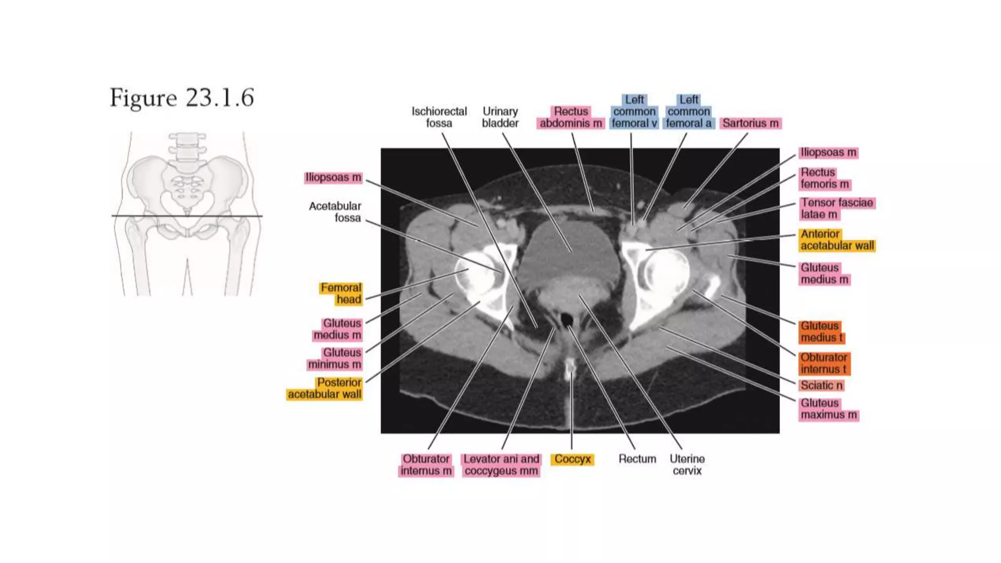 Gowtham's 2nd ca cervix anatomy | PPT