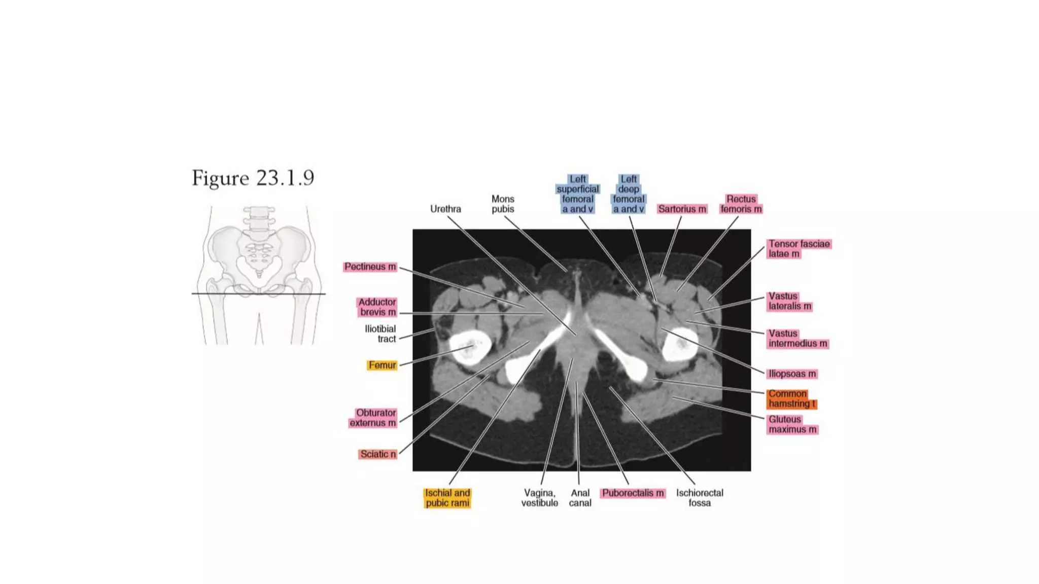 Gowthams 2nd Ca Cervix Anatomy Ppt