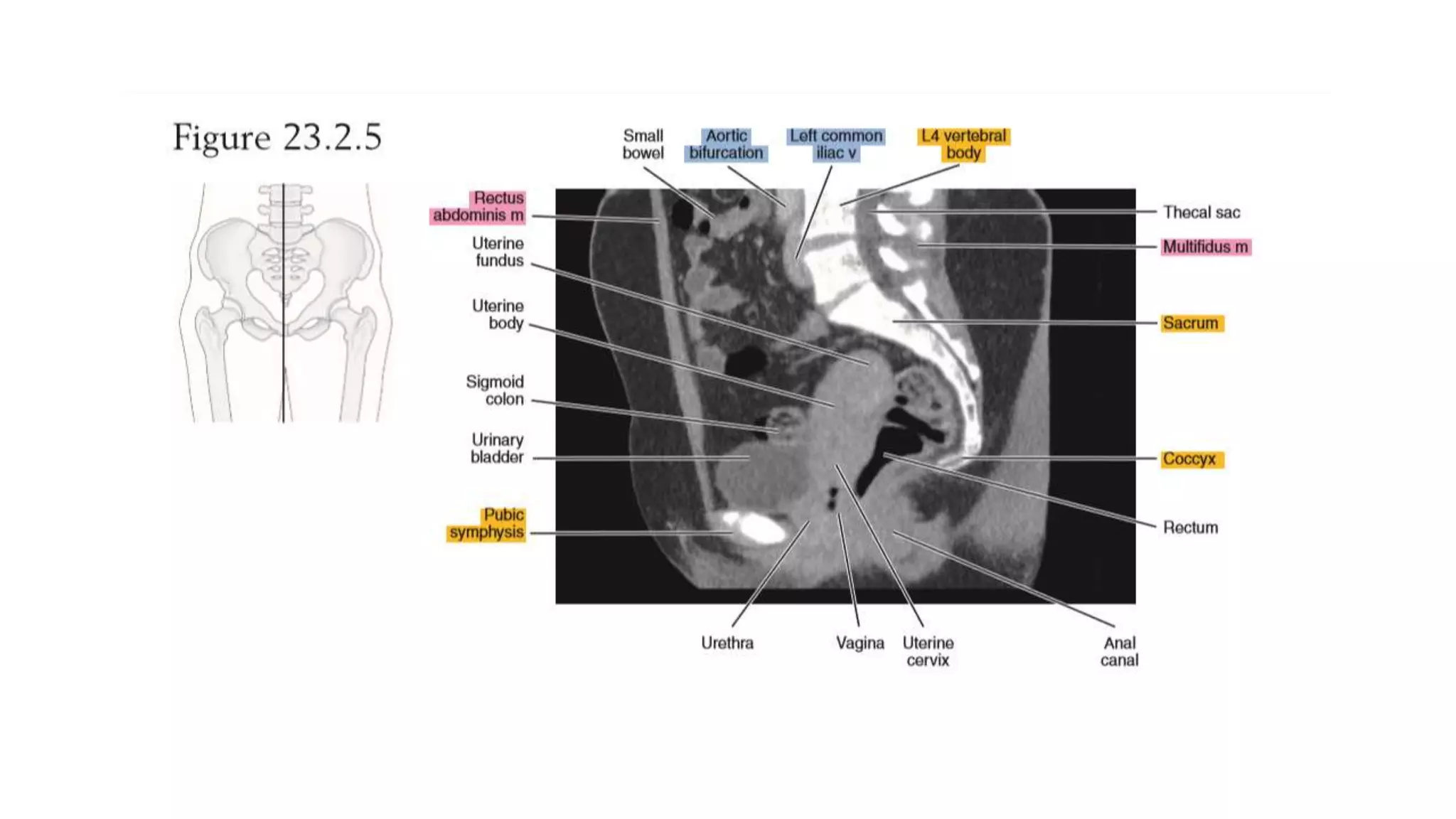 Gowtham's 2nd ca cervix anatomy | PPT