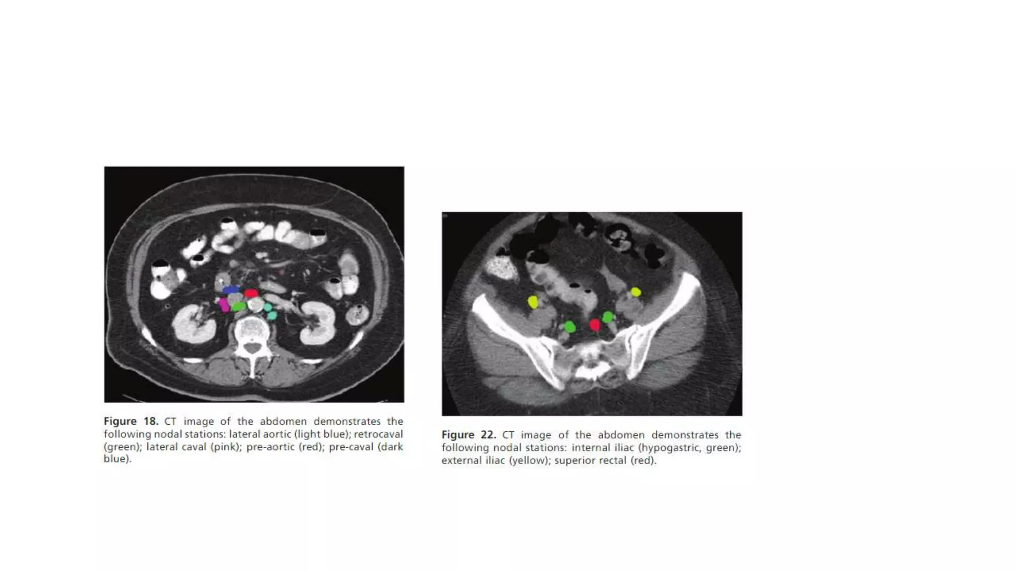 Gowtham's 2nd ca cervix anatomy | PPT