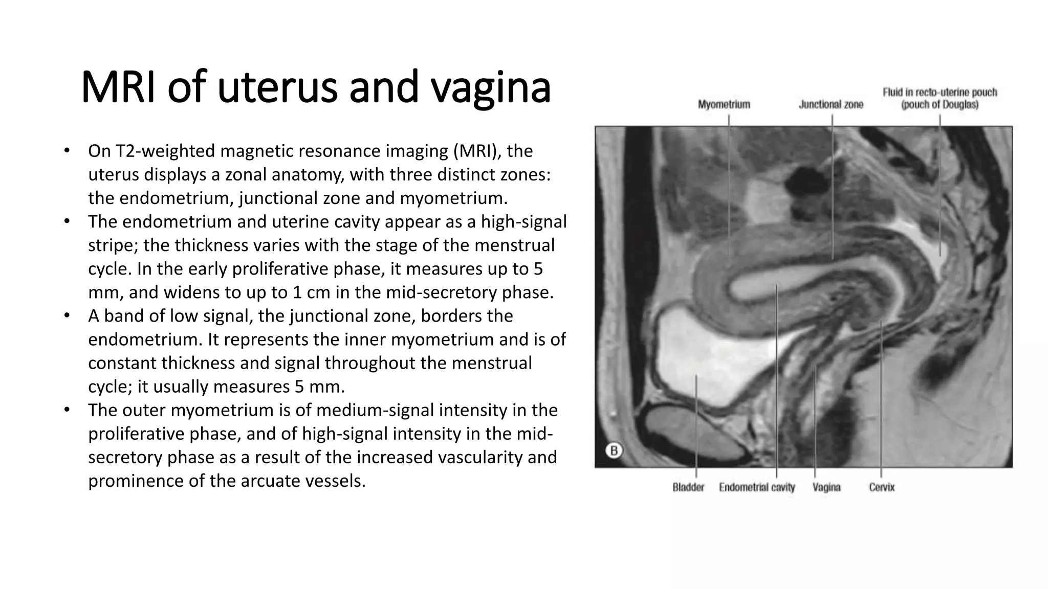 Gowtham's 2nd ca cervix anatomy | PPT