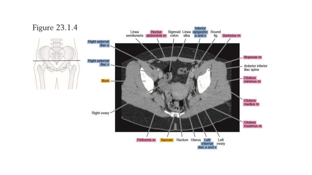 Gowtham's 2nd ca cervix anatomy | PPT