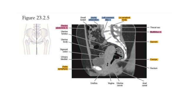 Gowthams 2nd Ca Cervix Anatomy Ppt