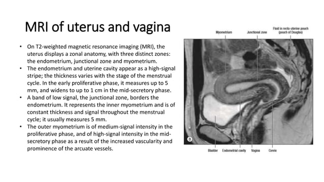 Gowtham's 2nd ca cervix anatomy | PPT