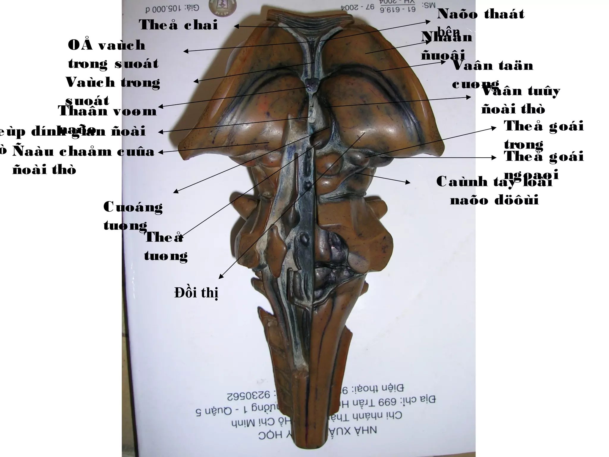 CHÚ THÍCH GIẢI PHẪU NÃO - THẦN KINH | PPT