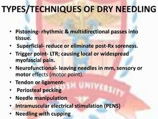 Gpacon 2018 dry needling | PPTX