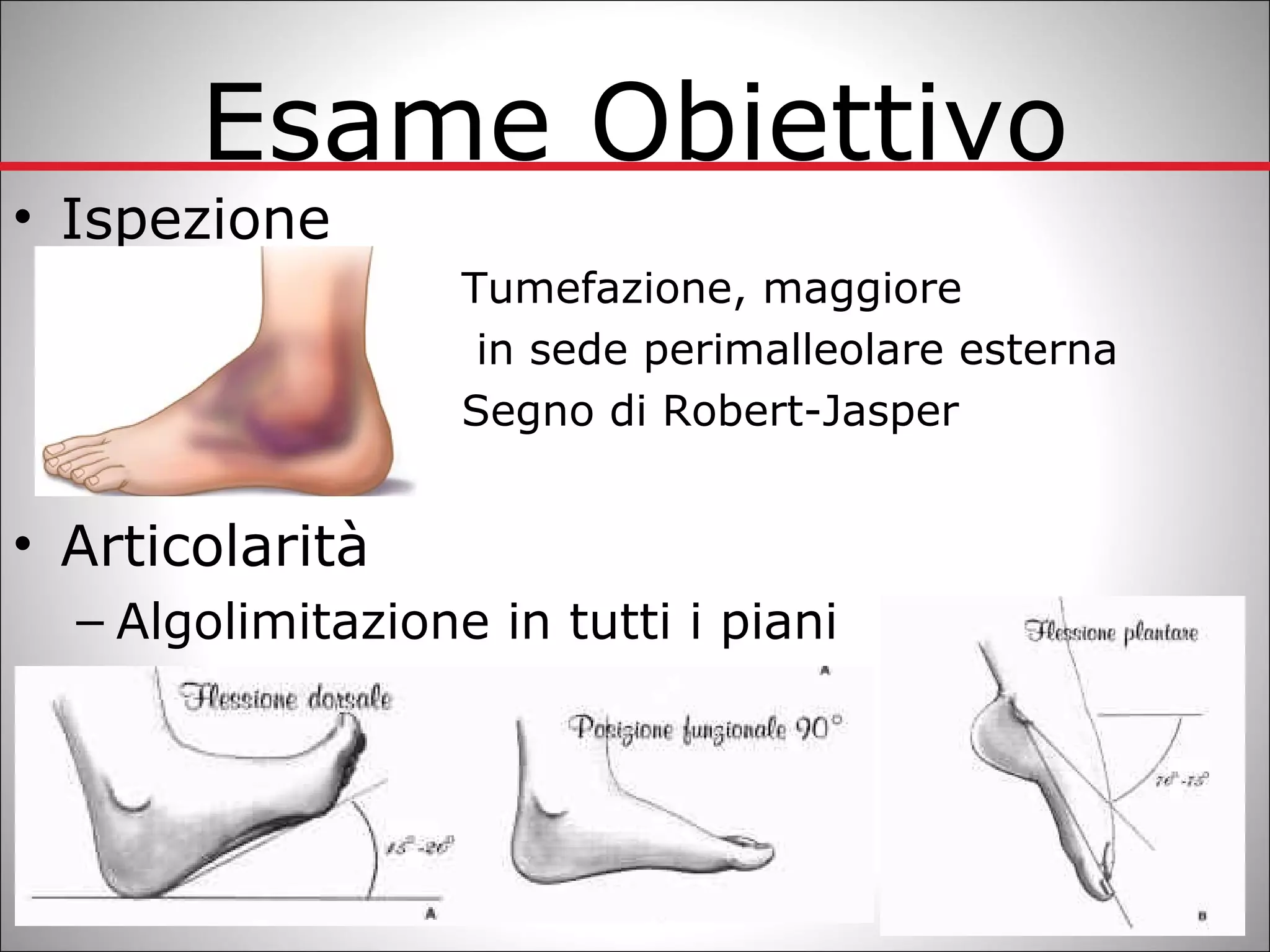 Caso clinico di distorsione di caviglia | PPT