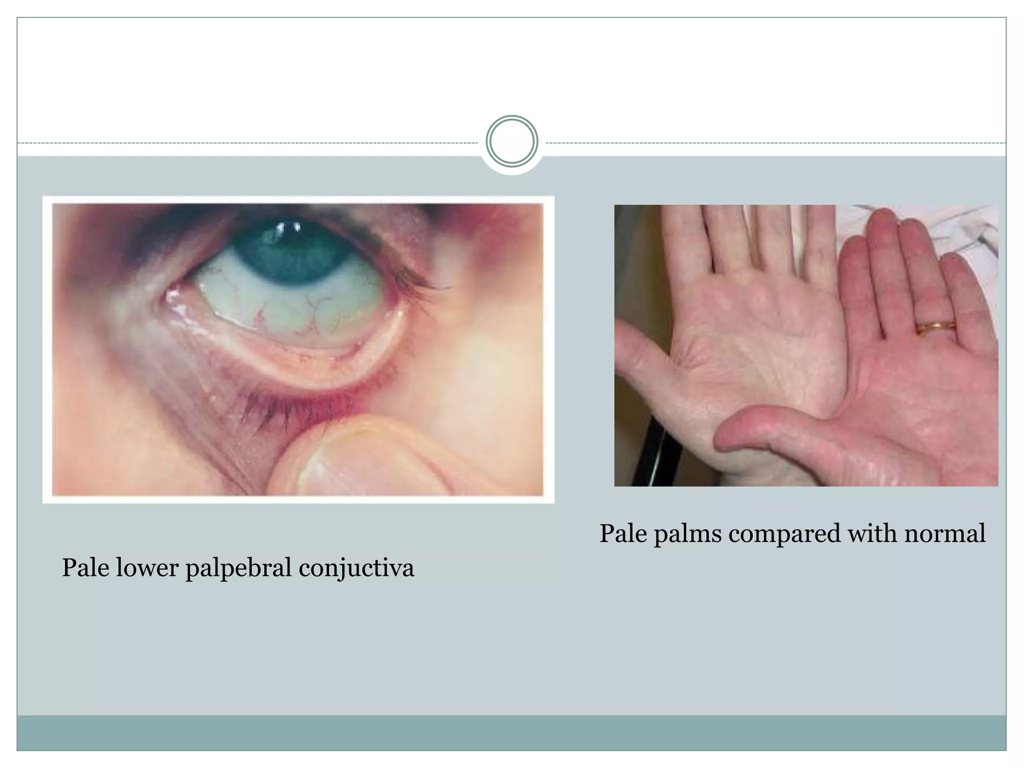 GENERAL PHYSICAL EXAMINATION | PPTX