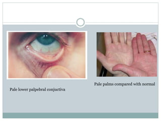 GENERAL PHYSICAL EXAMINATION | PPTX
