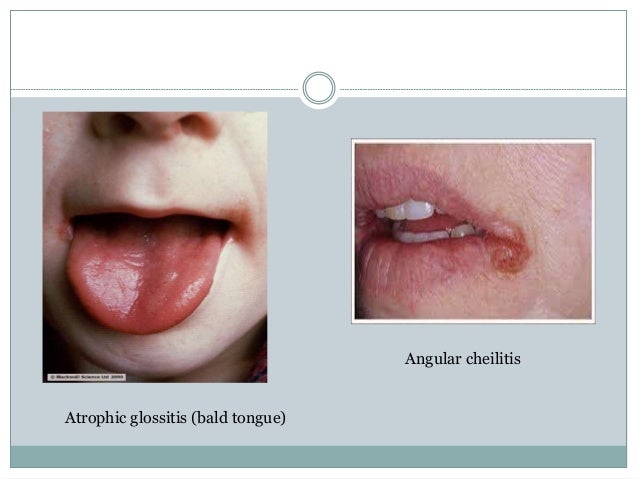 GENERAL PHYSICAL EXAMINATION