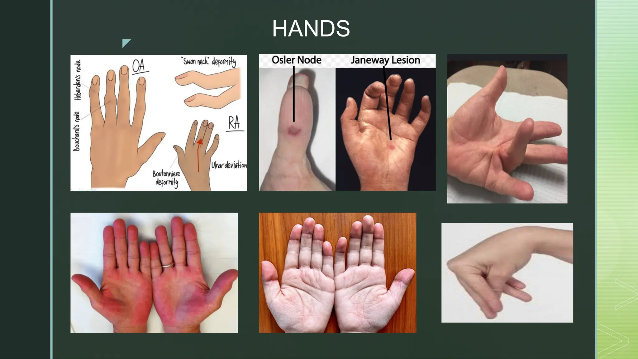 General Physical Examination in GPE.pptx