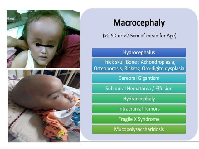 General physical Examination | PPTX