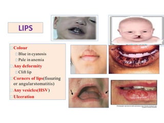 General physical Examination | PPTX