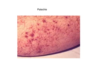 General Physical Examination Pictures | PPT