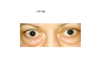 General Physical Examination Pictures | PPT