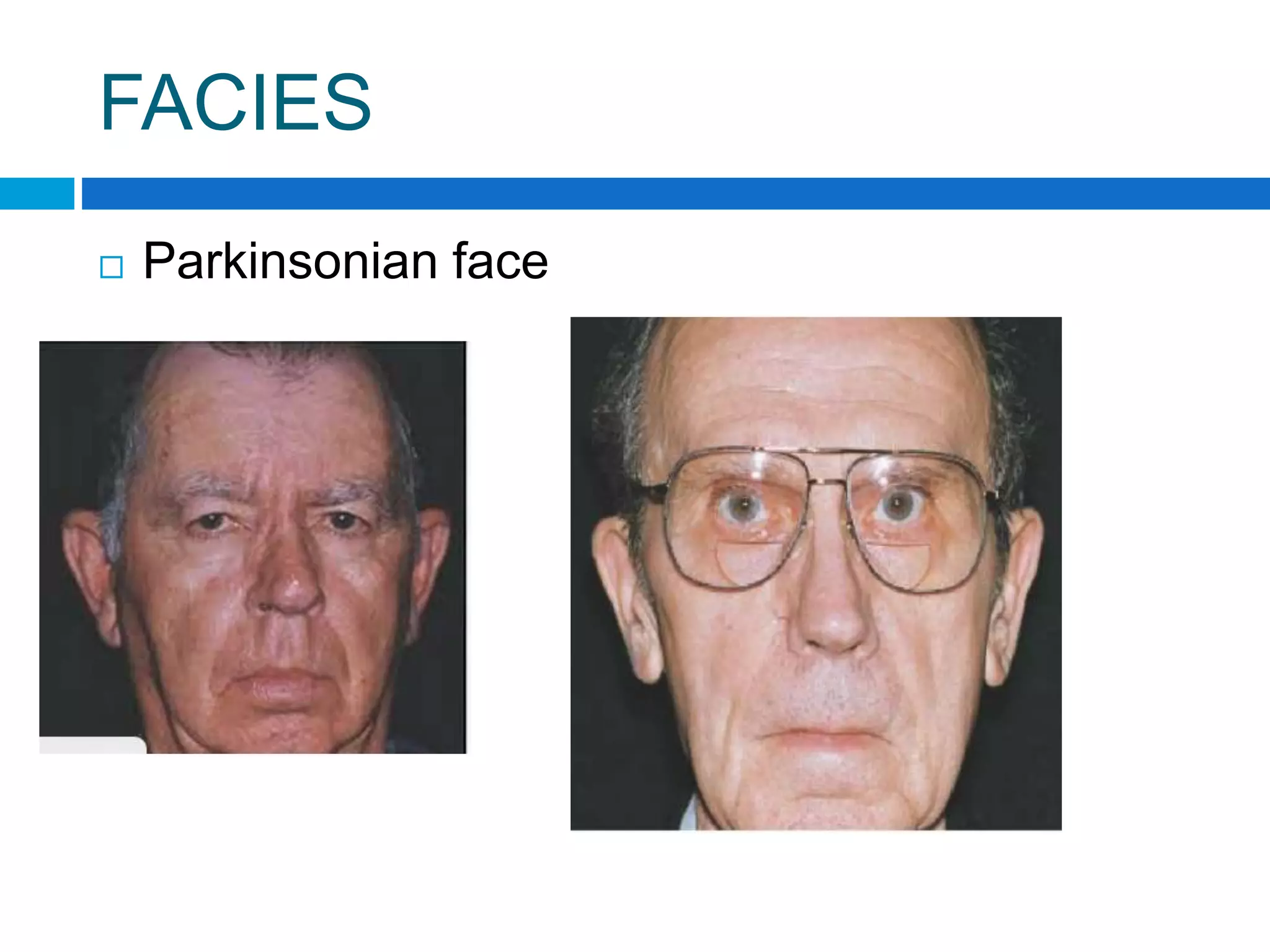 General Physical Examination in Neurological Diseases | PPTX