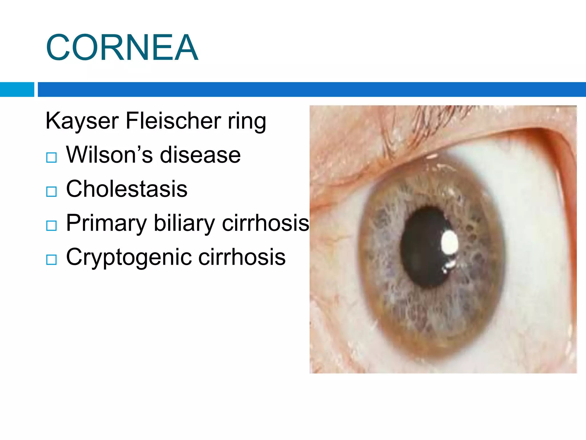 General Physical Examination in Neurological Diseases | PPTX