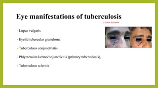 General Physical Examination in Respiratory Diseases | PPTX